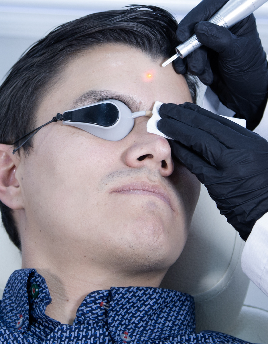 Laser CO2 - Dayana Arenas